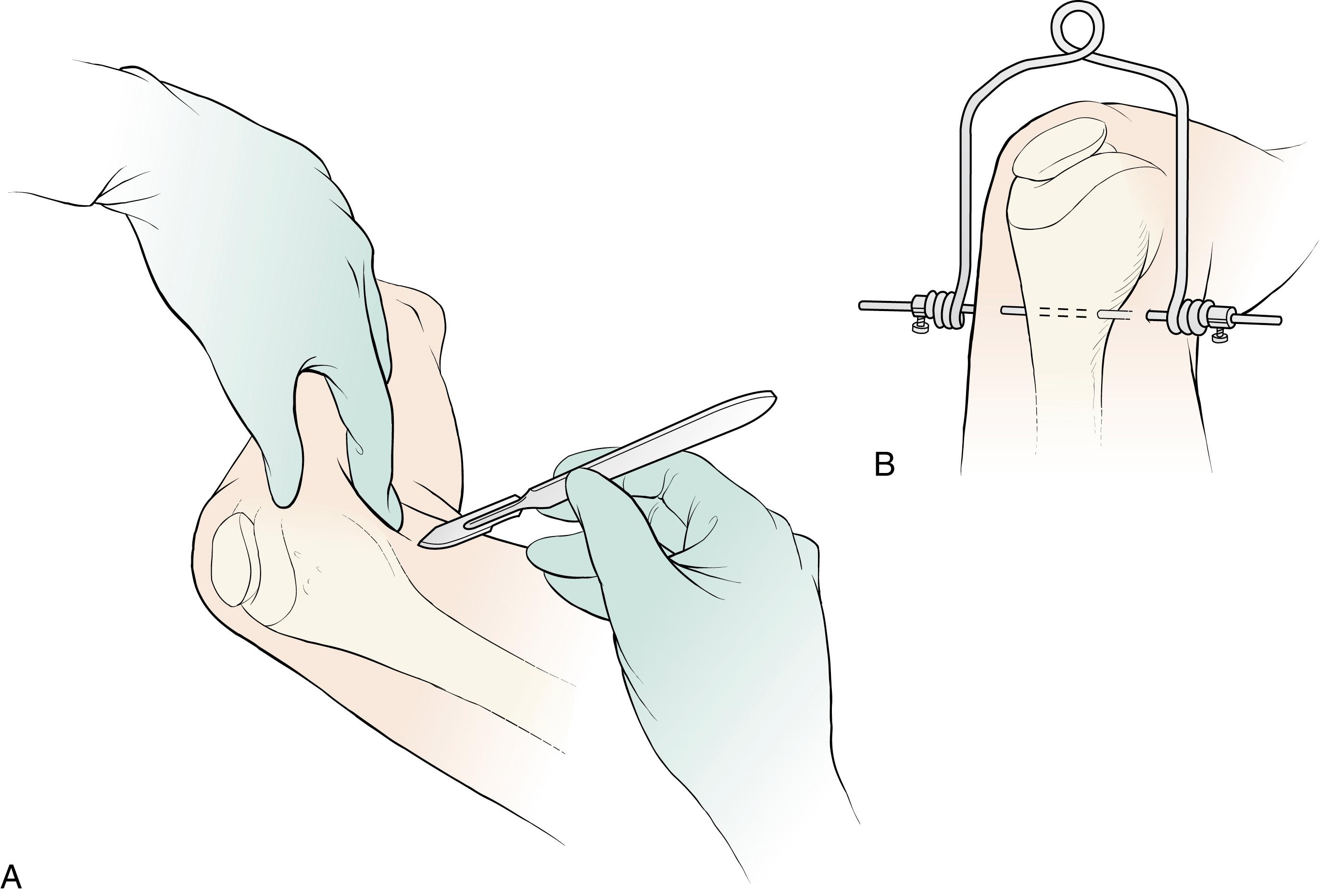 Lower Extremity Injuries - Clinical Tree