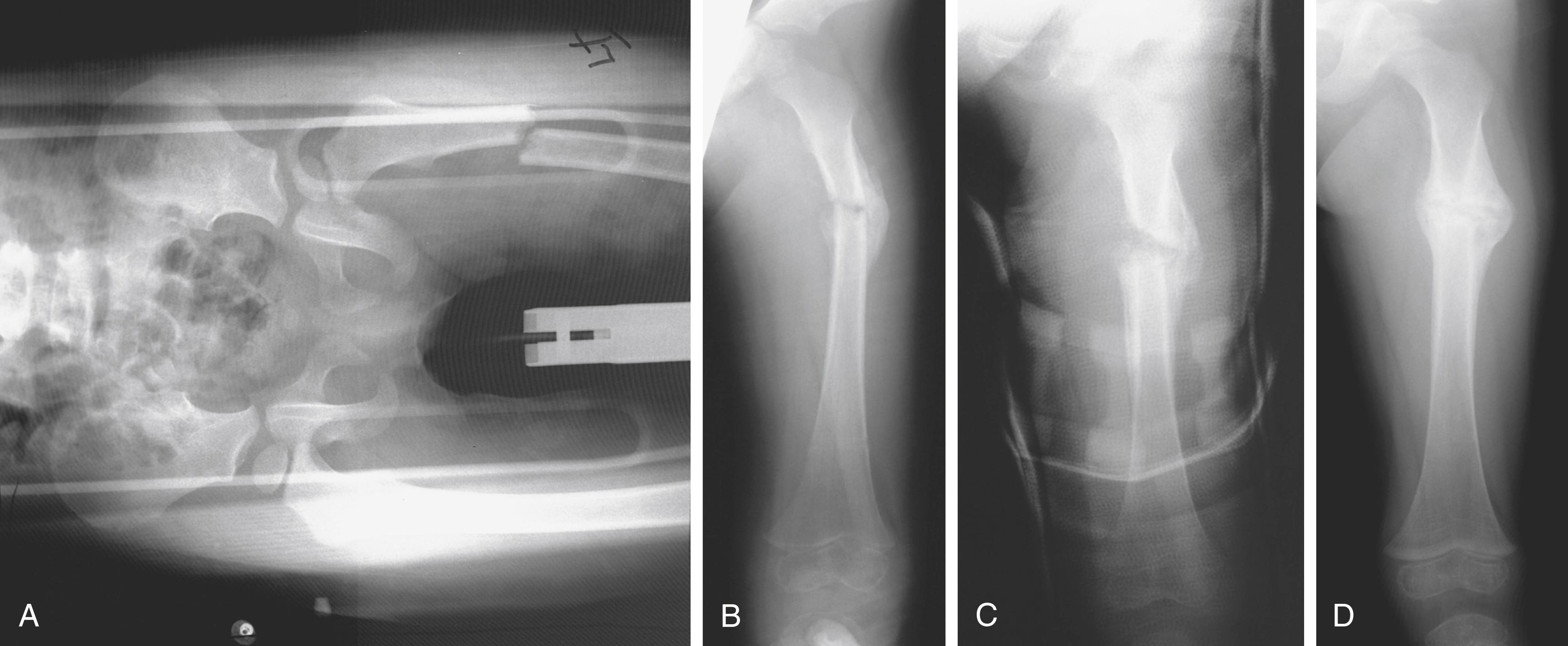 Lower Extremity Injuries - Clinical Tree