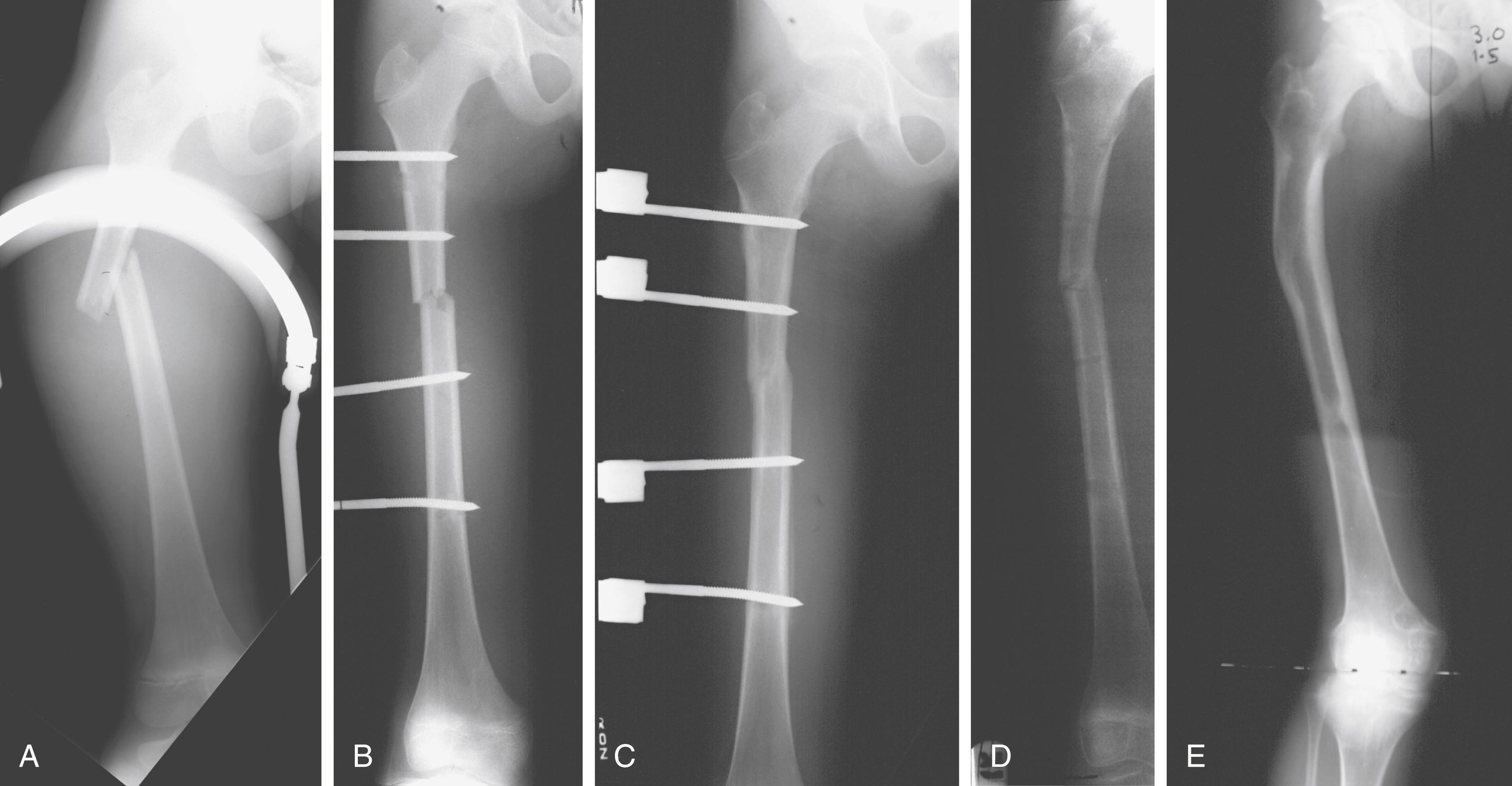 Lower Extremity Injuries - Clinical Tree