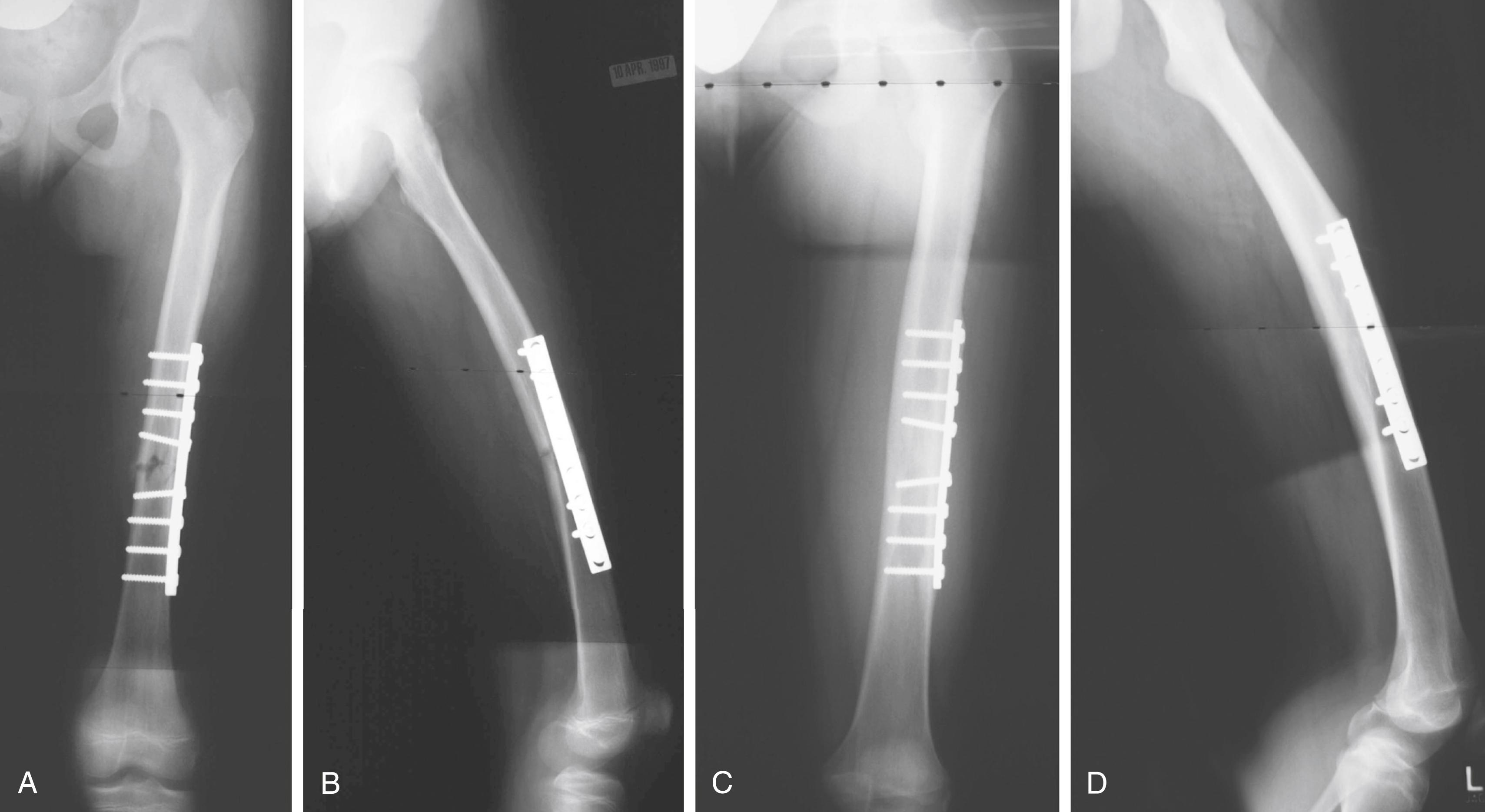 Lower Extremity Injuries - Clinical Tree