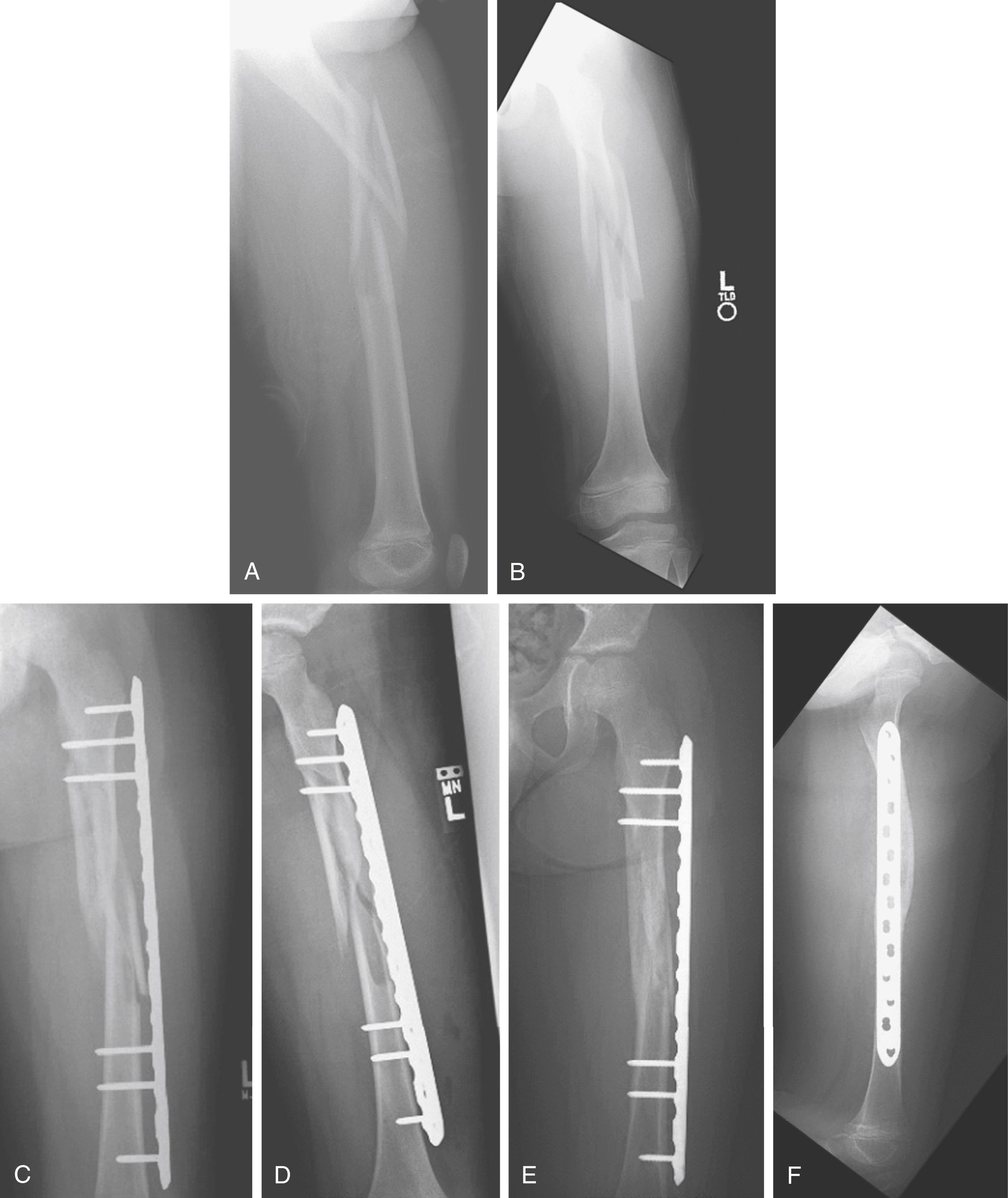 Lower Extremity Injuries - Clinical Tree