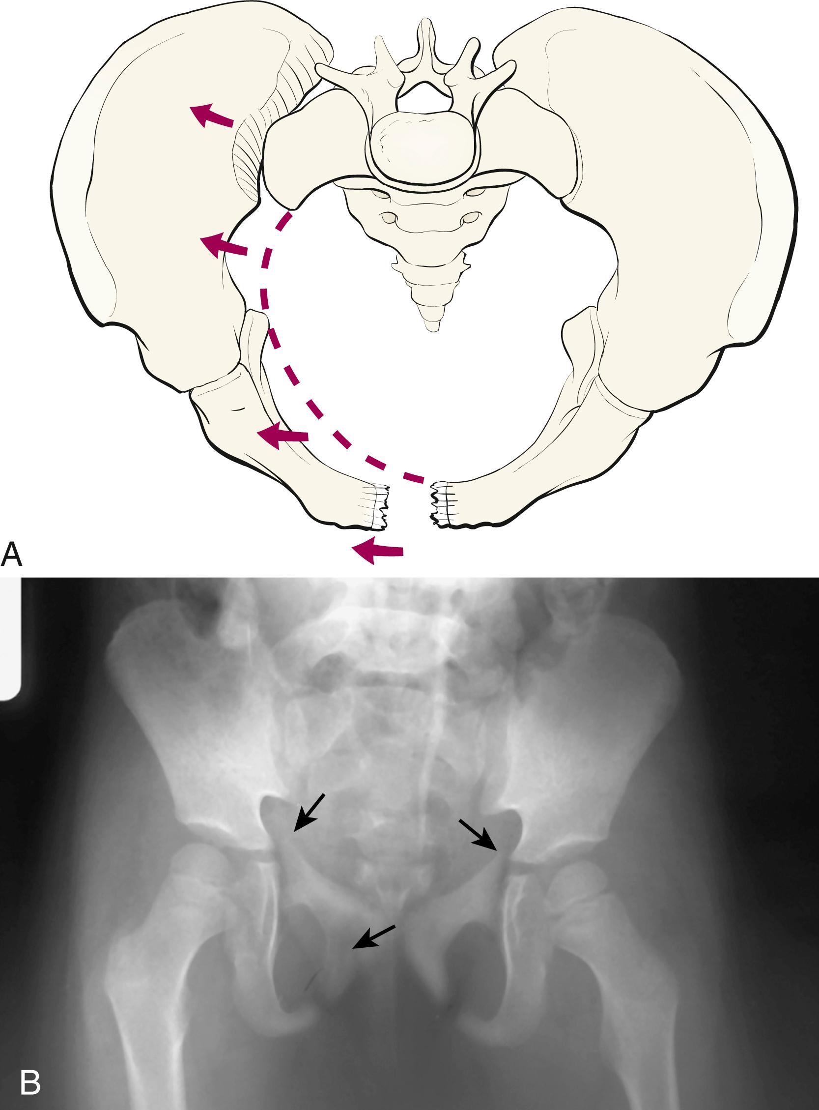 Lower Extremity Injuries - Clinical Tree