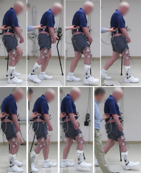 Lower Extremity Motor System Neuroprostheses - Clinical Tree