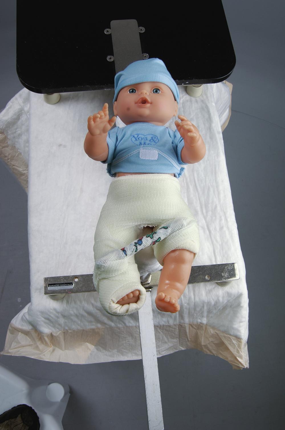 Lower Extremity Splints and Casts - Clinical Tree