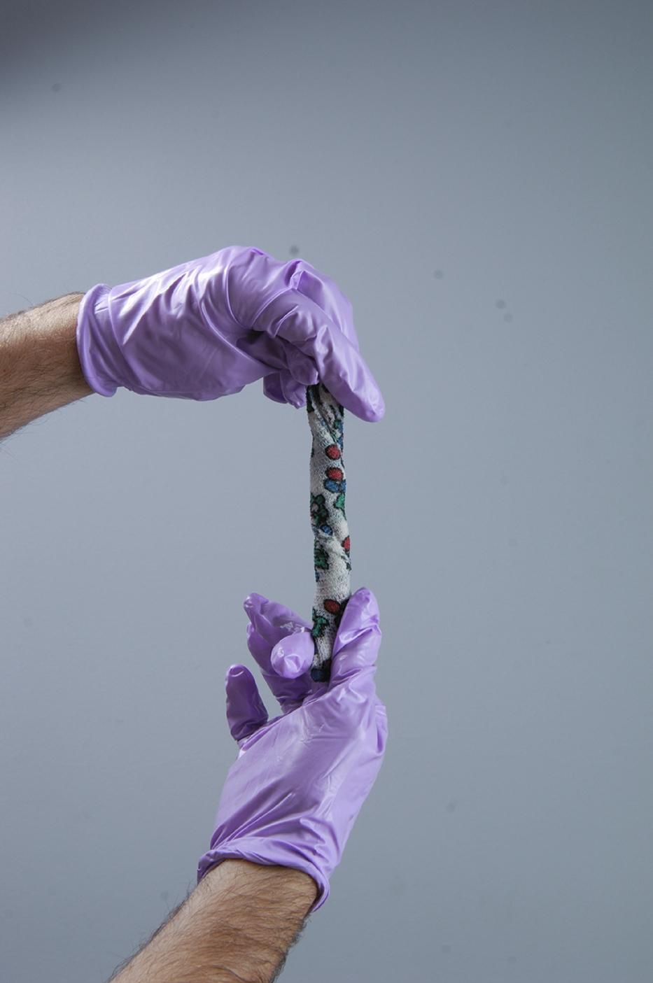 Lower Extremity Splints and Casts - Clinical Tree