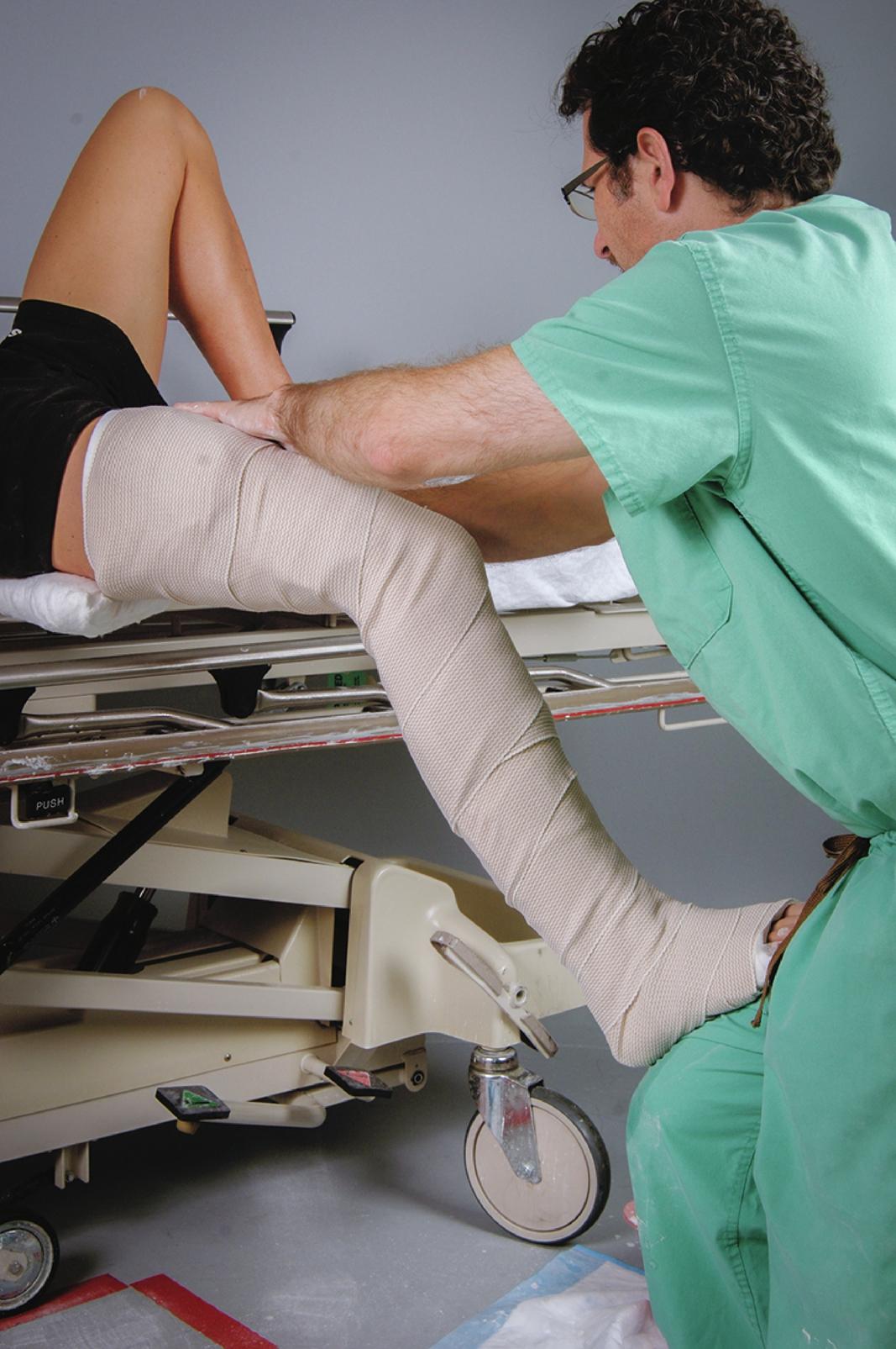 Lower Extremity Splints and Casts - Clinical Tree