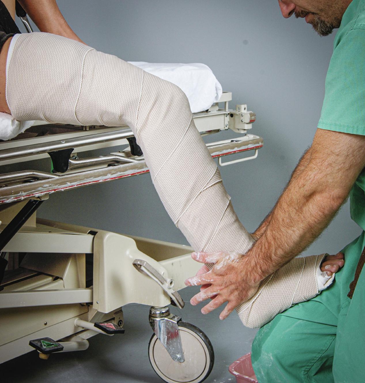 Lower Extremity Splints and Casts - Clinical Tree