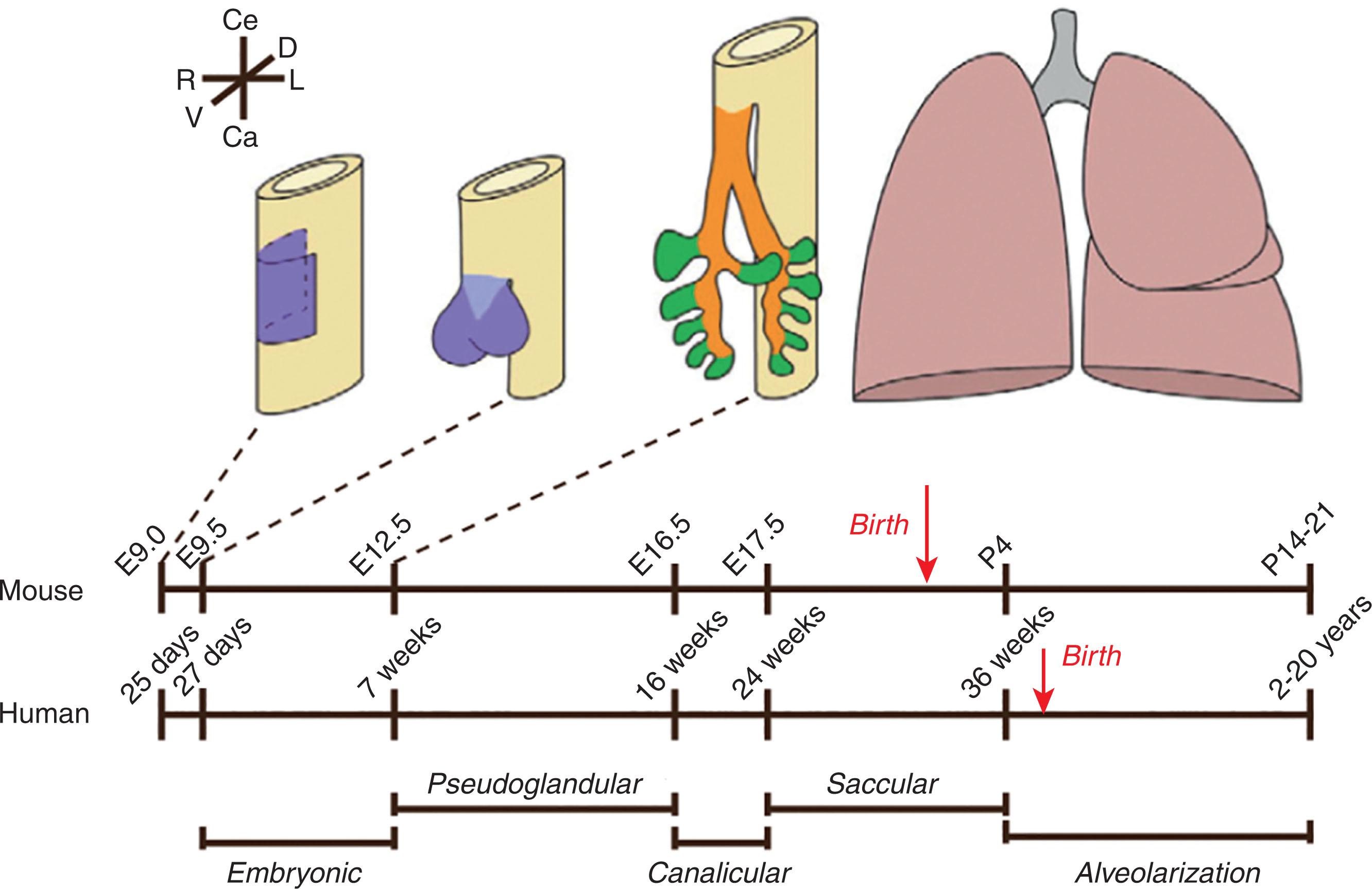Lung Development - Clinical Tree