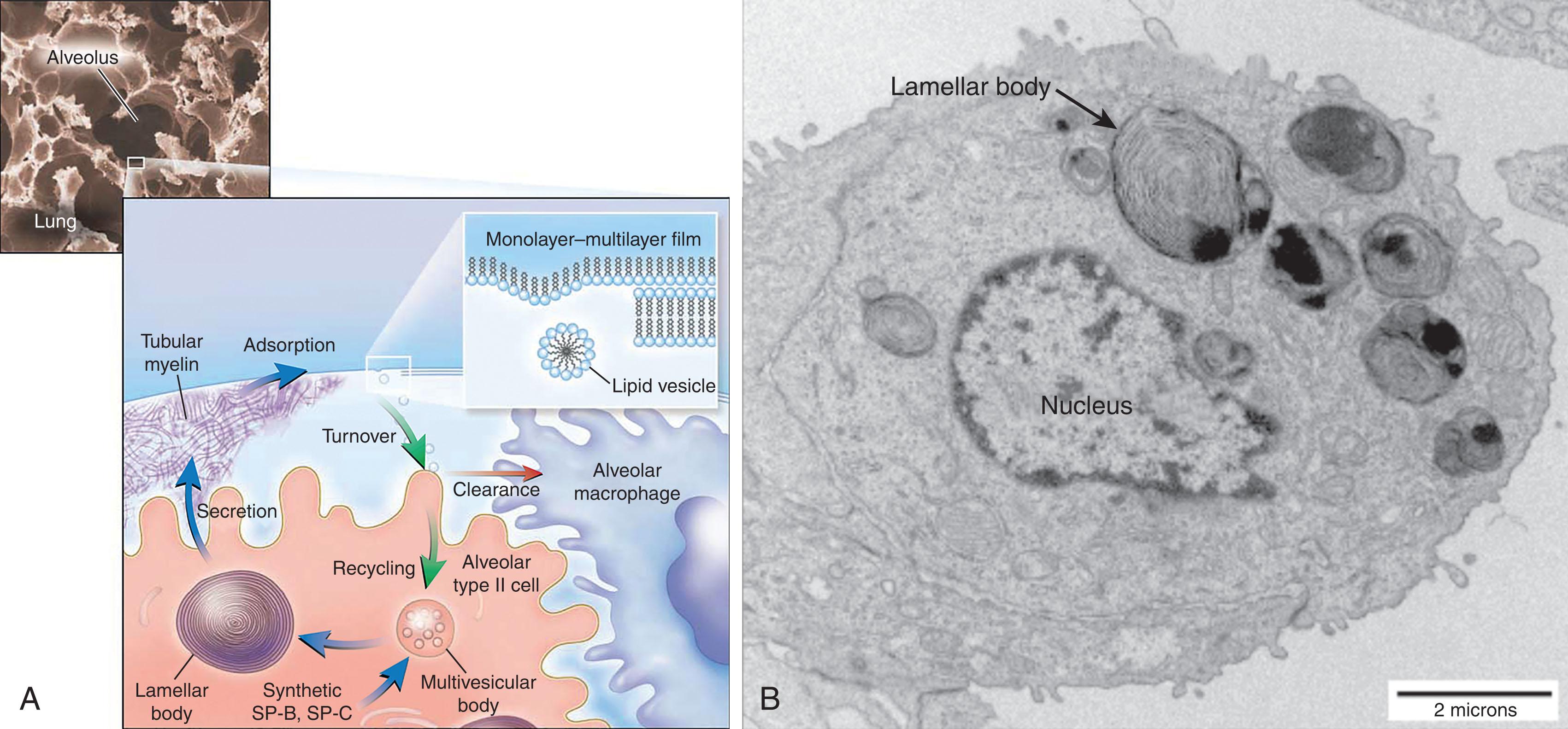 Lung Development - Clinical Tree