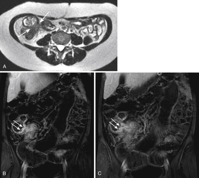 MRI of the Gastrointestinal System - Clinical Tree