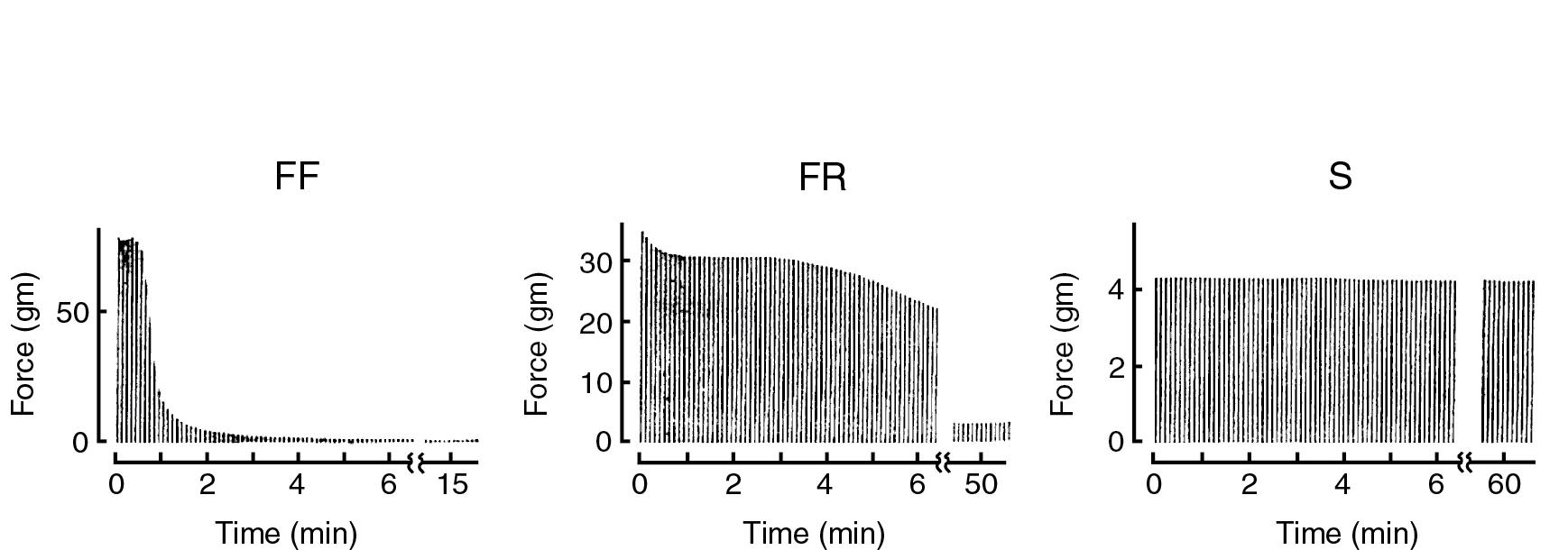 Mechanics of muscle contraction - Clinical Tree