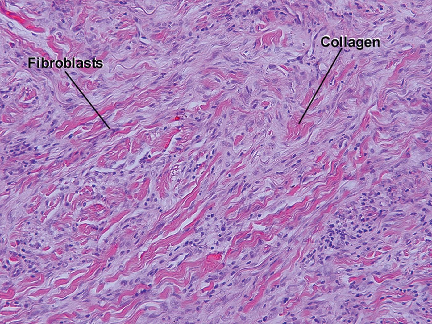 Metabolic disorders - Clinical Tree