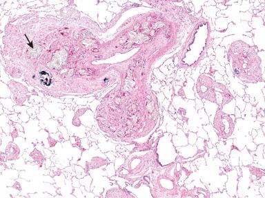 Microscopic Findings - Clinical Tree