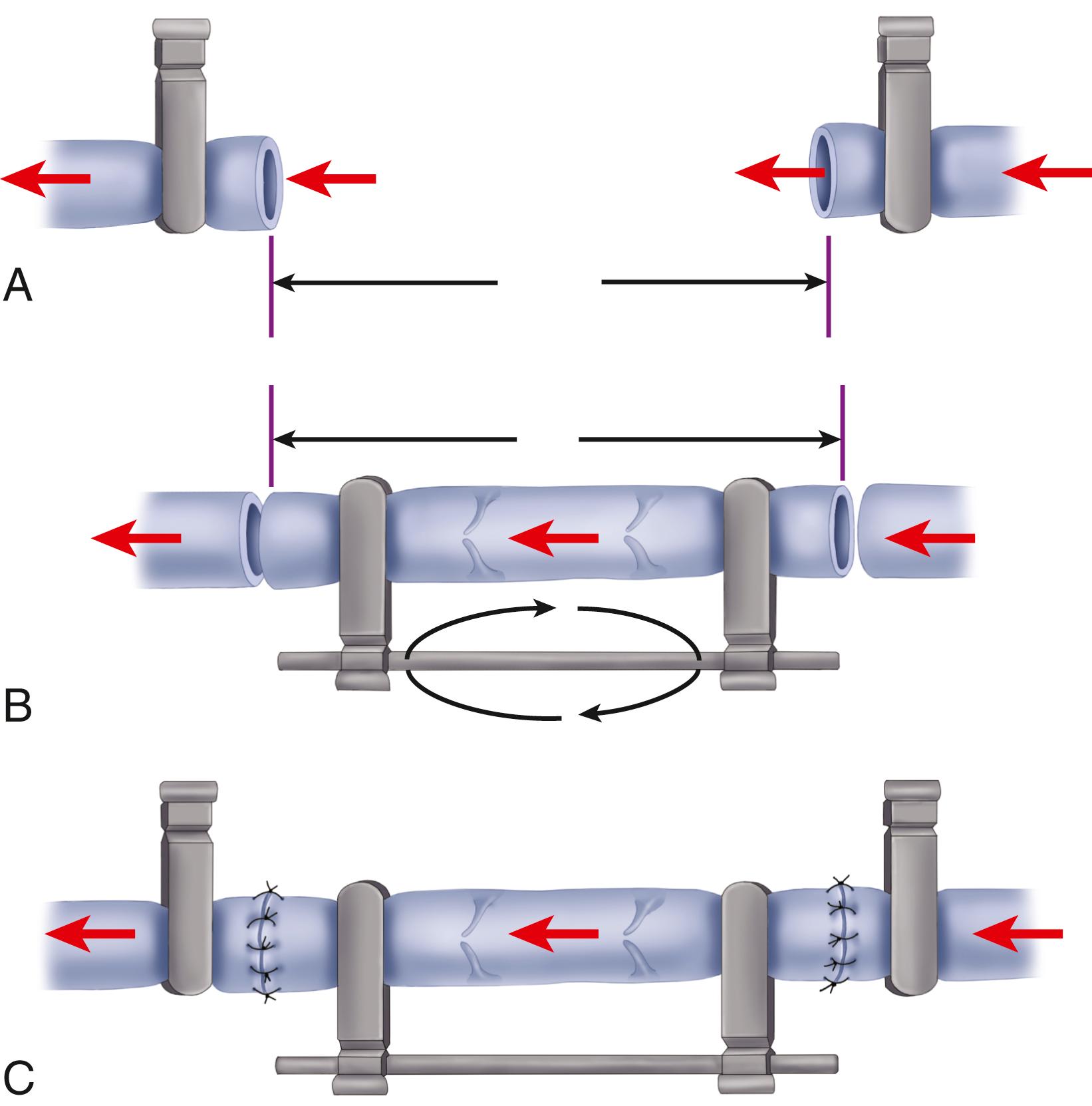 Microsurgery - Clinical Tree