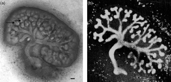 Molecular and Cellular Mechanisms of Kidney Development - Clinical Tree