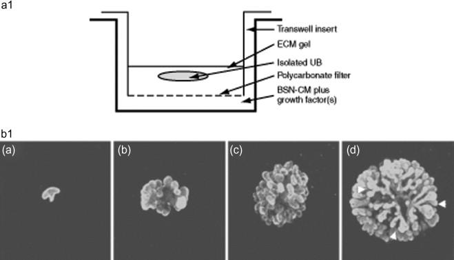Molecular and Cellular Mechanisms of Kidney Development - Clinical Tree