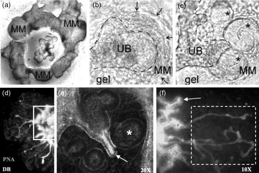 Molecular and Cellular Mechanisms of Kidney Development - Clinical Tree