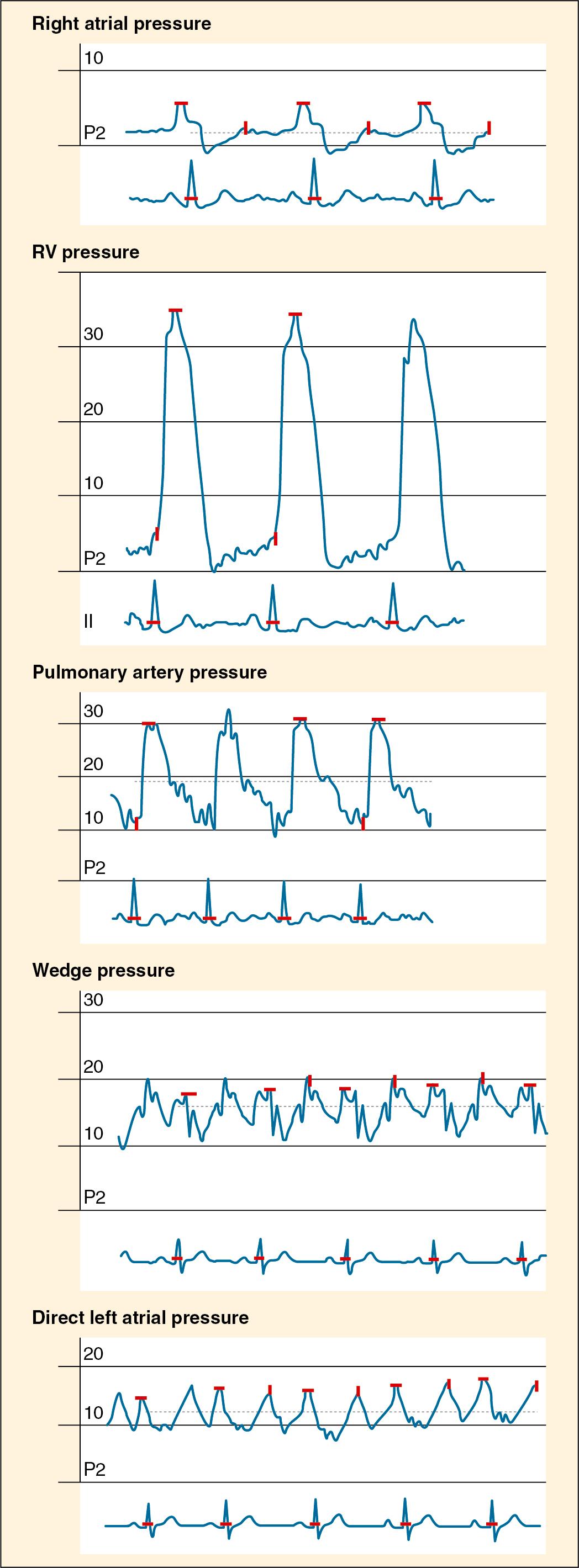 Monitoring - Clinical Tree