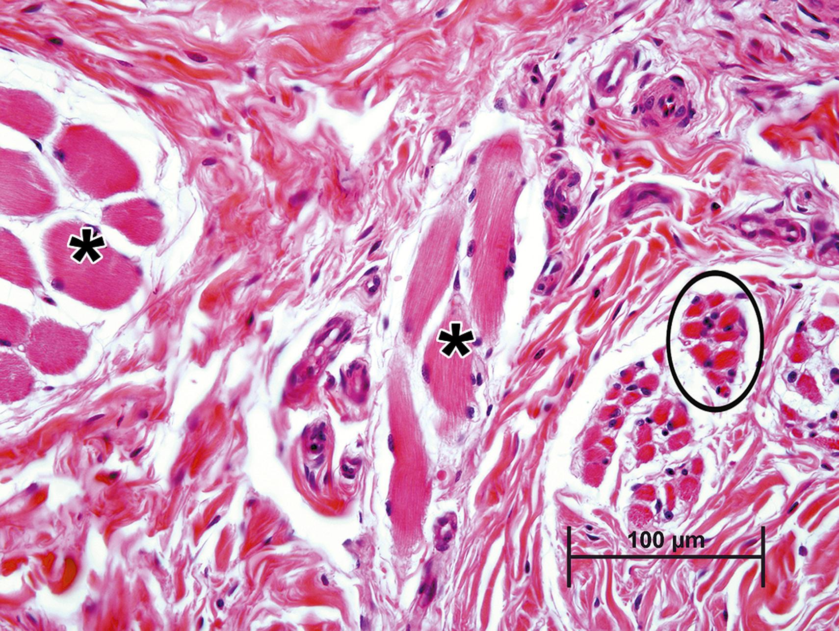Morphologic Manifestations of Toxic Cell Injury - Clinical Tree