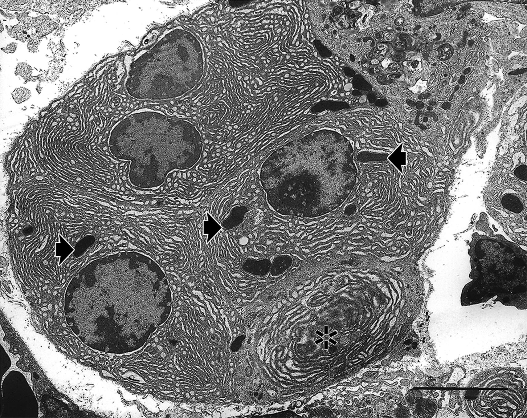 Morphologic Manifestations of Toxic Cell Injury - Clinical Tree