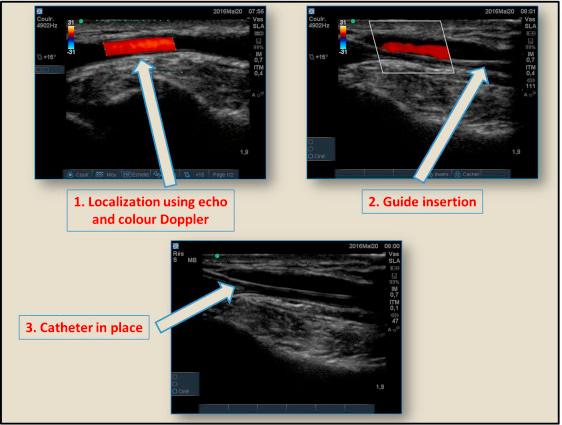 Multimodal Monitoring - Clinical Tree