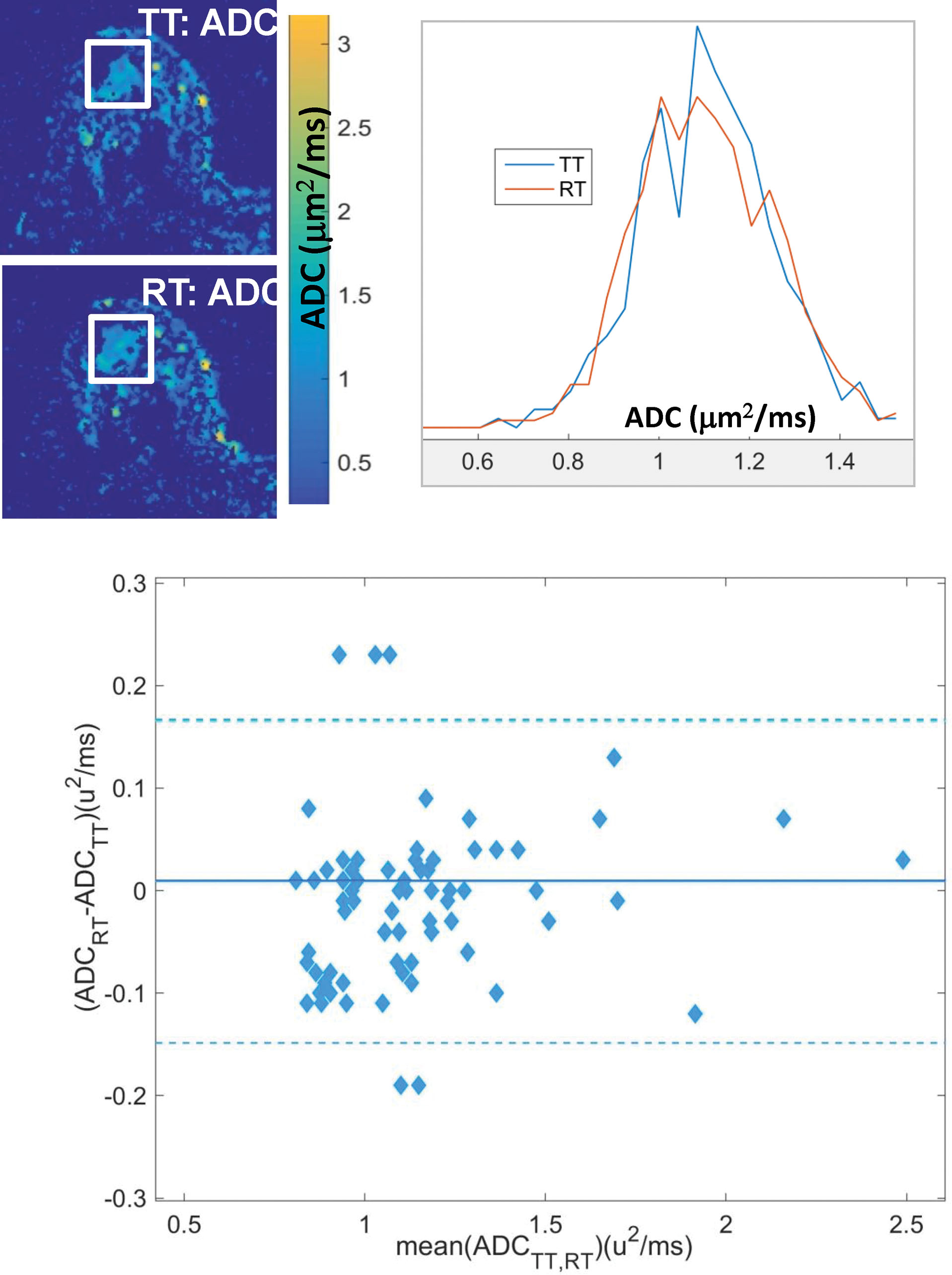 Multiplatform Standardization of Breast DWI Protocols: Quality Control ...