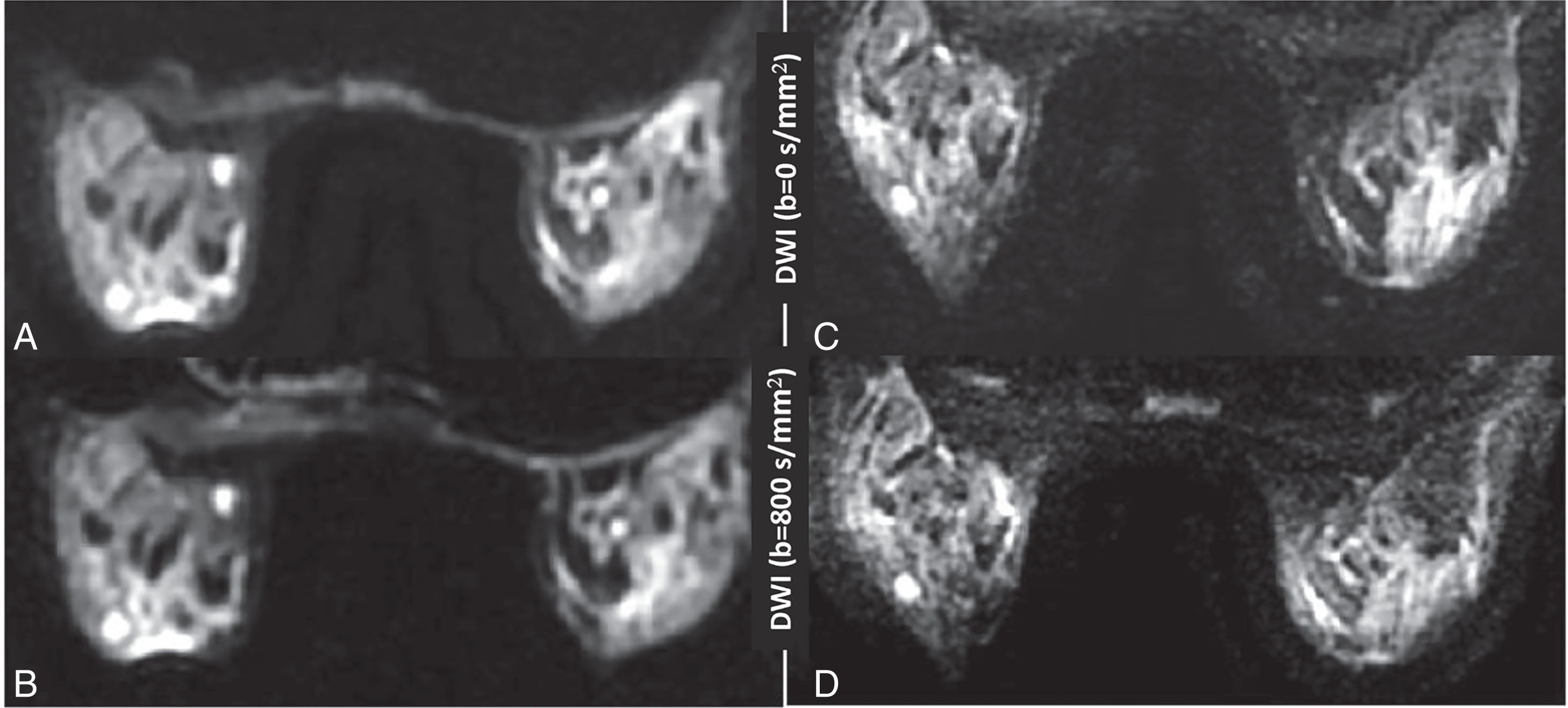 Multiplatform Standardization of Breast DWI Protocols: Quality Control ...