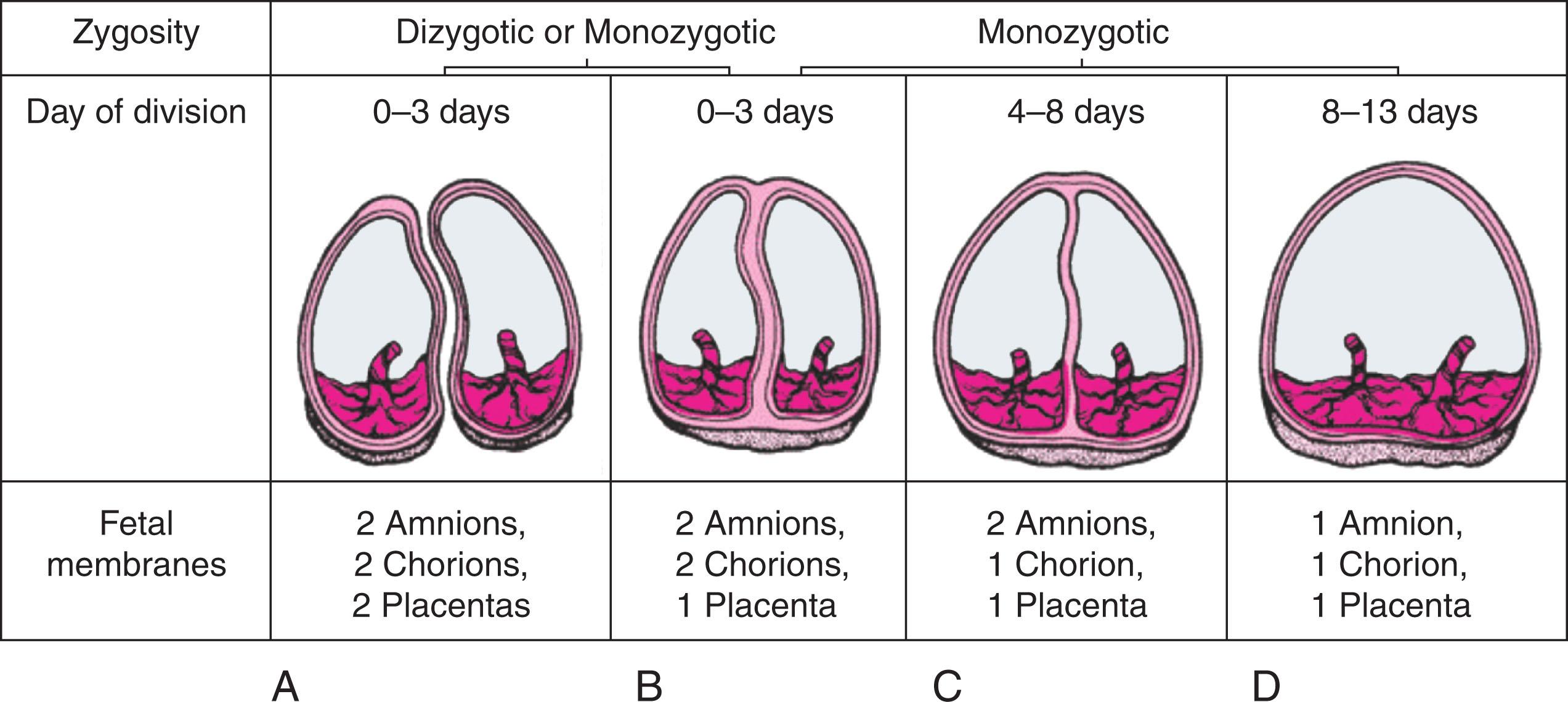 Multiple Gestations and Assisted Reproductive Technology - Clinical Tree