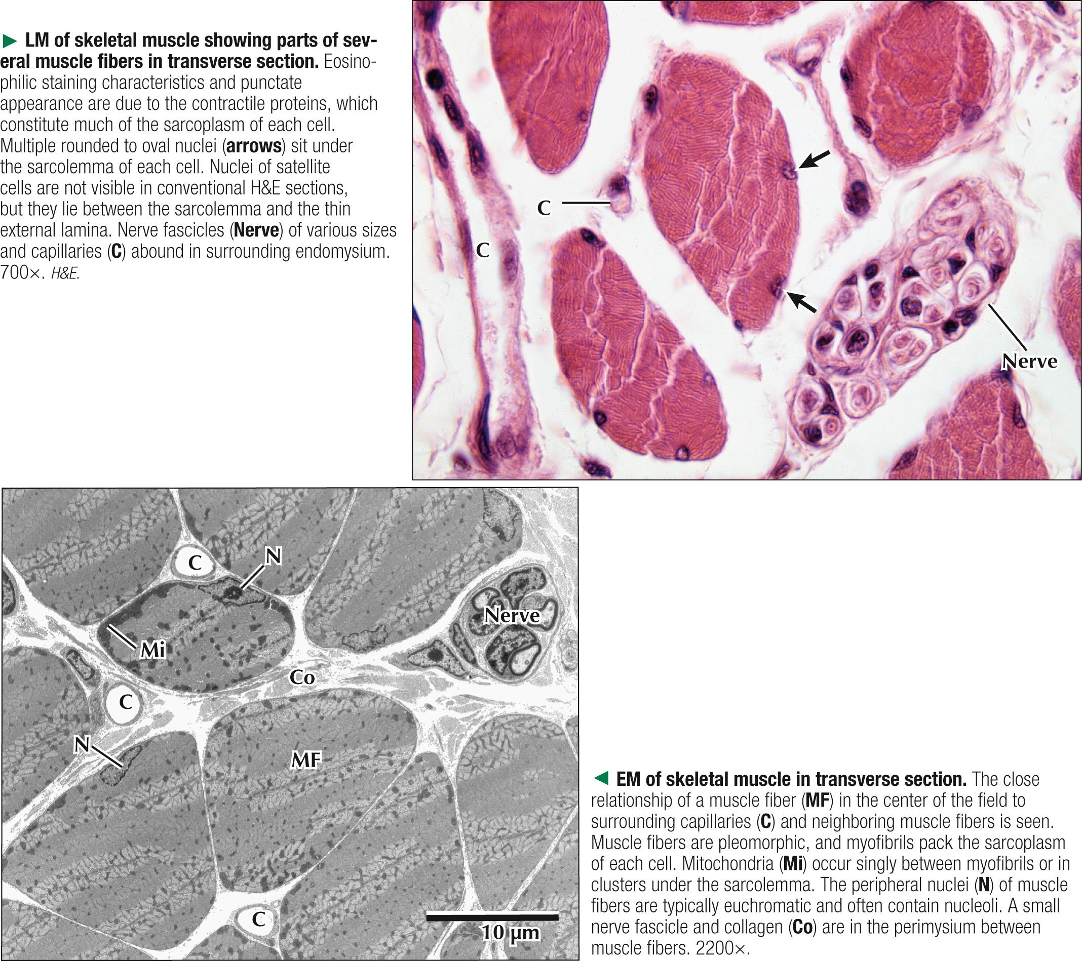 Muscle Tissue - Clinical Tree