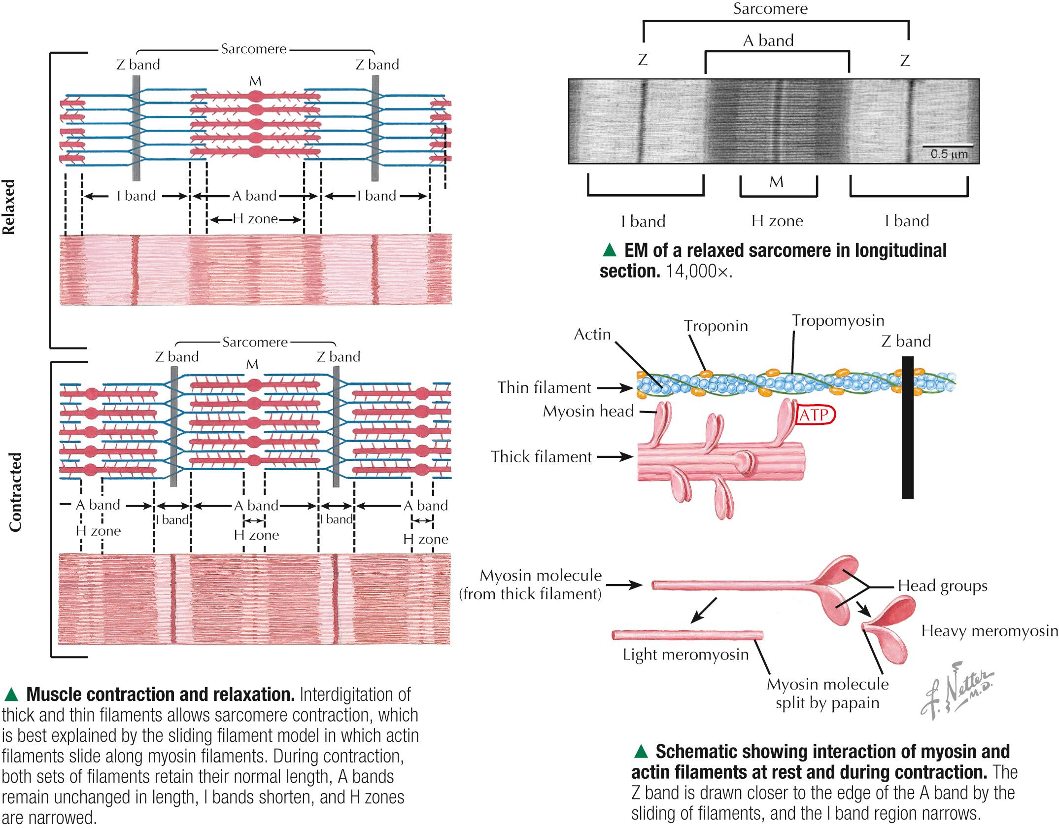 Muscle Tissue - Clinical Tree