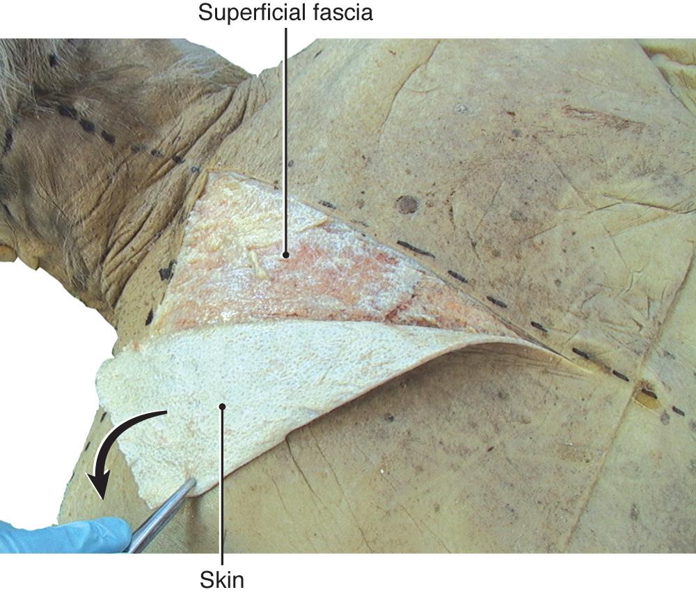 Muscles of the Back and Scapula - Clinical Tree