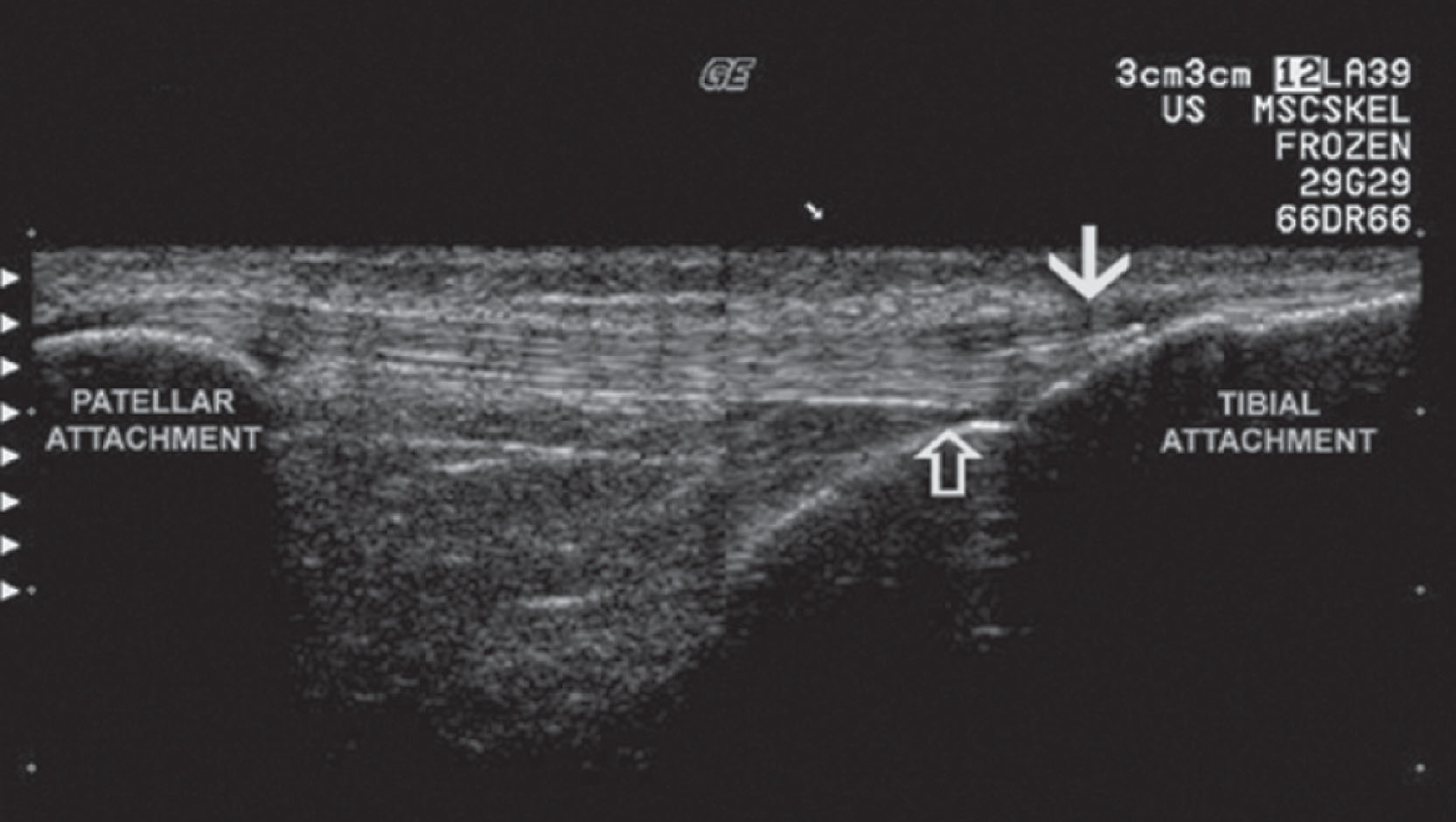 Musculoskeletal System - Clinical Tree