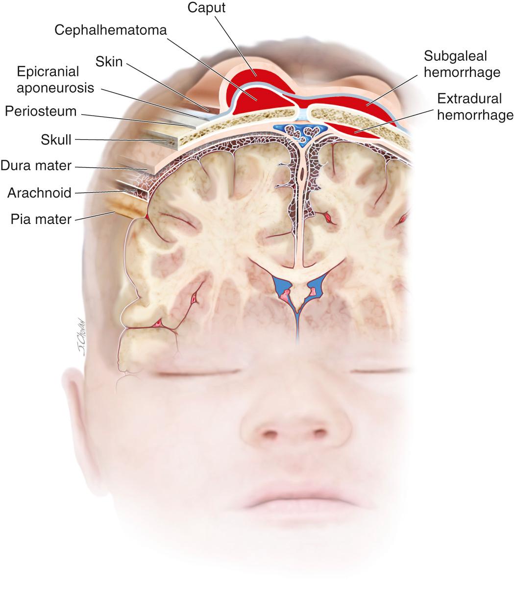 Nervous System Disorders - Clinical Tree
