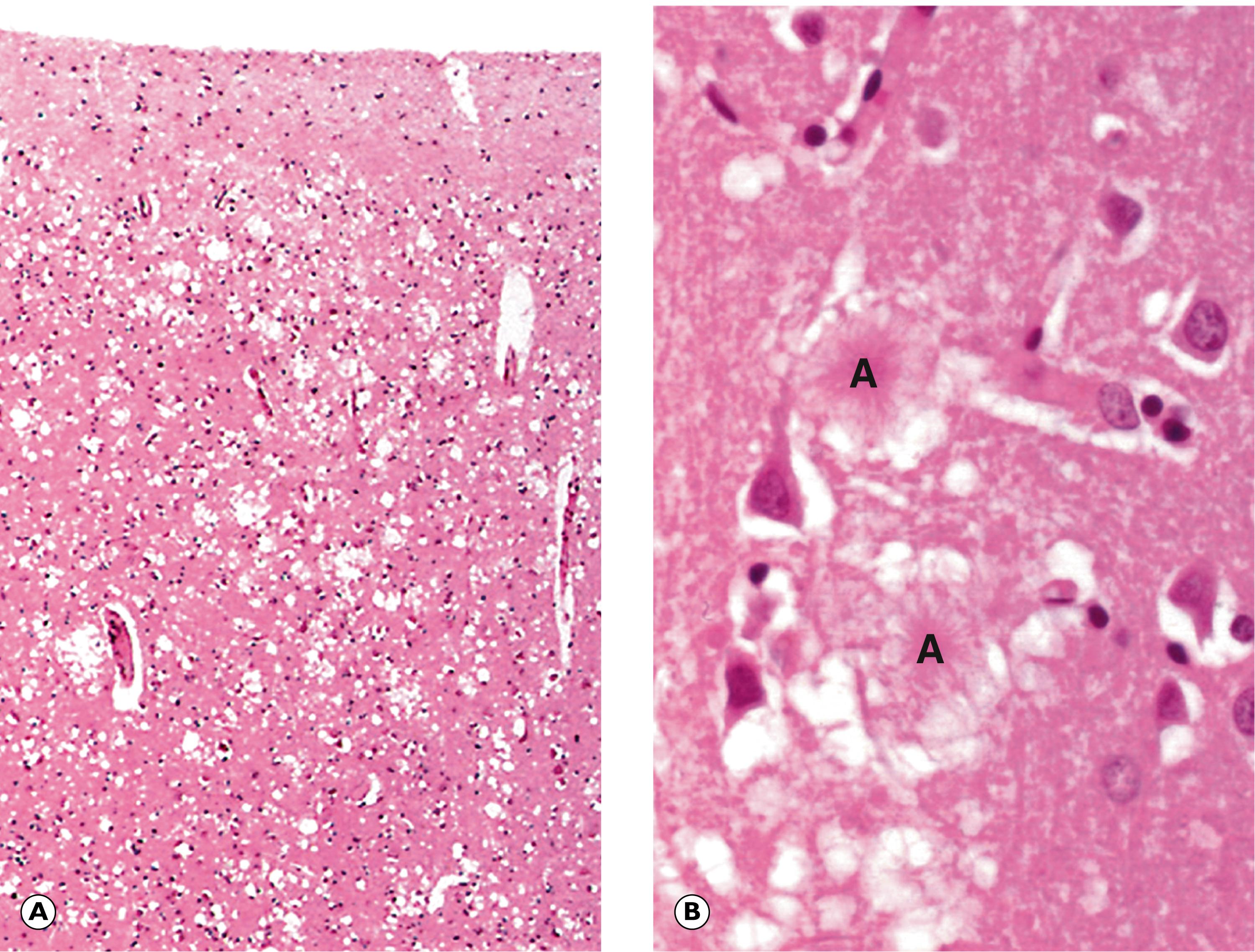 Nervous system - Clinical Tree