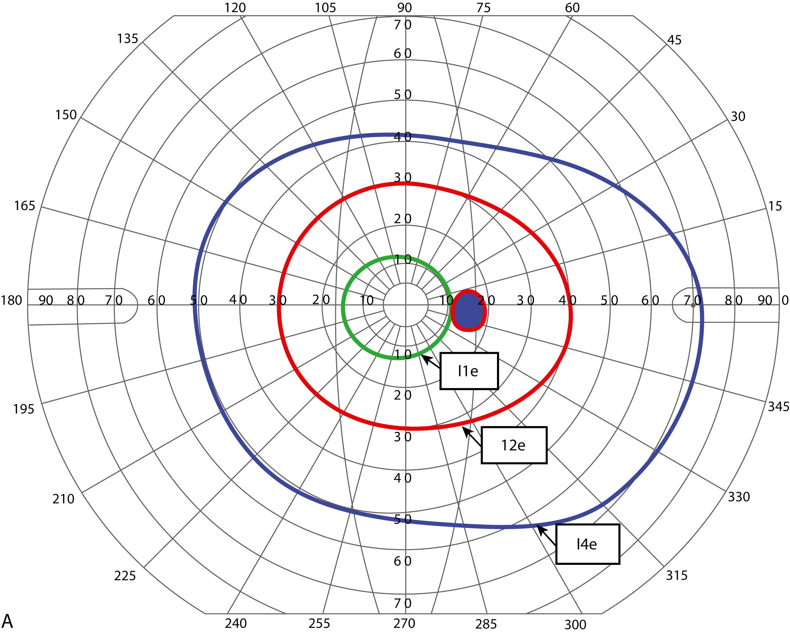 Neuro-Ophthalmology: Afferent Visual System - Clinical Tree