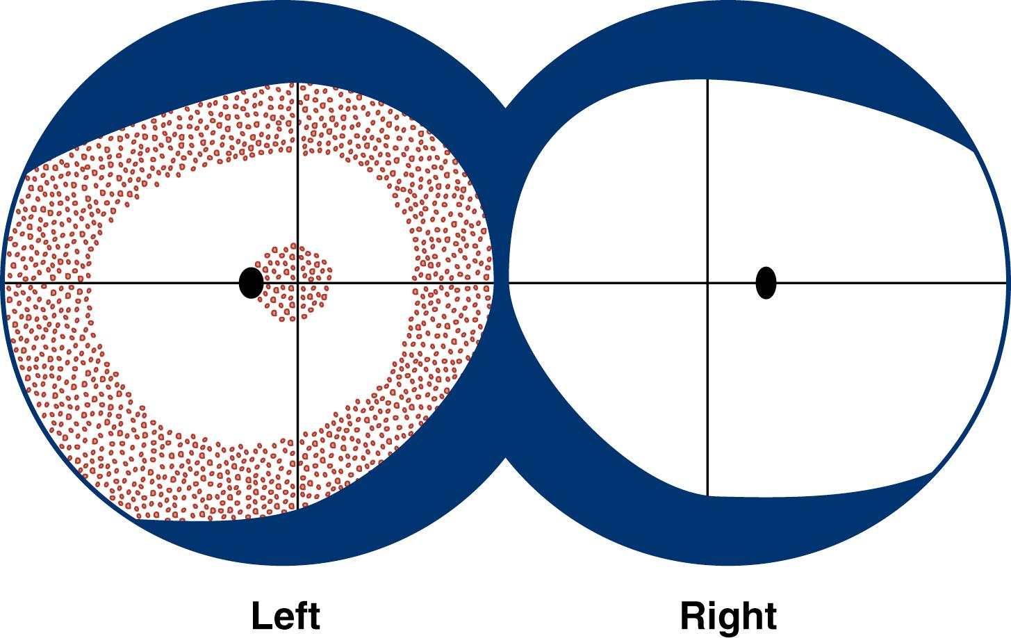 Neuro-Ophthalmology: Afferent Visual System - Clinical Tree
