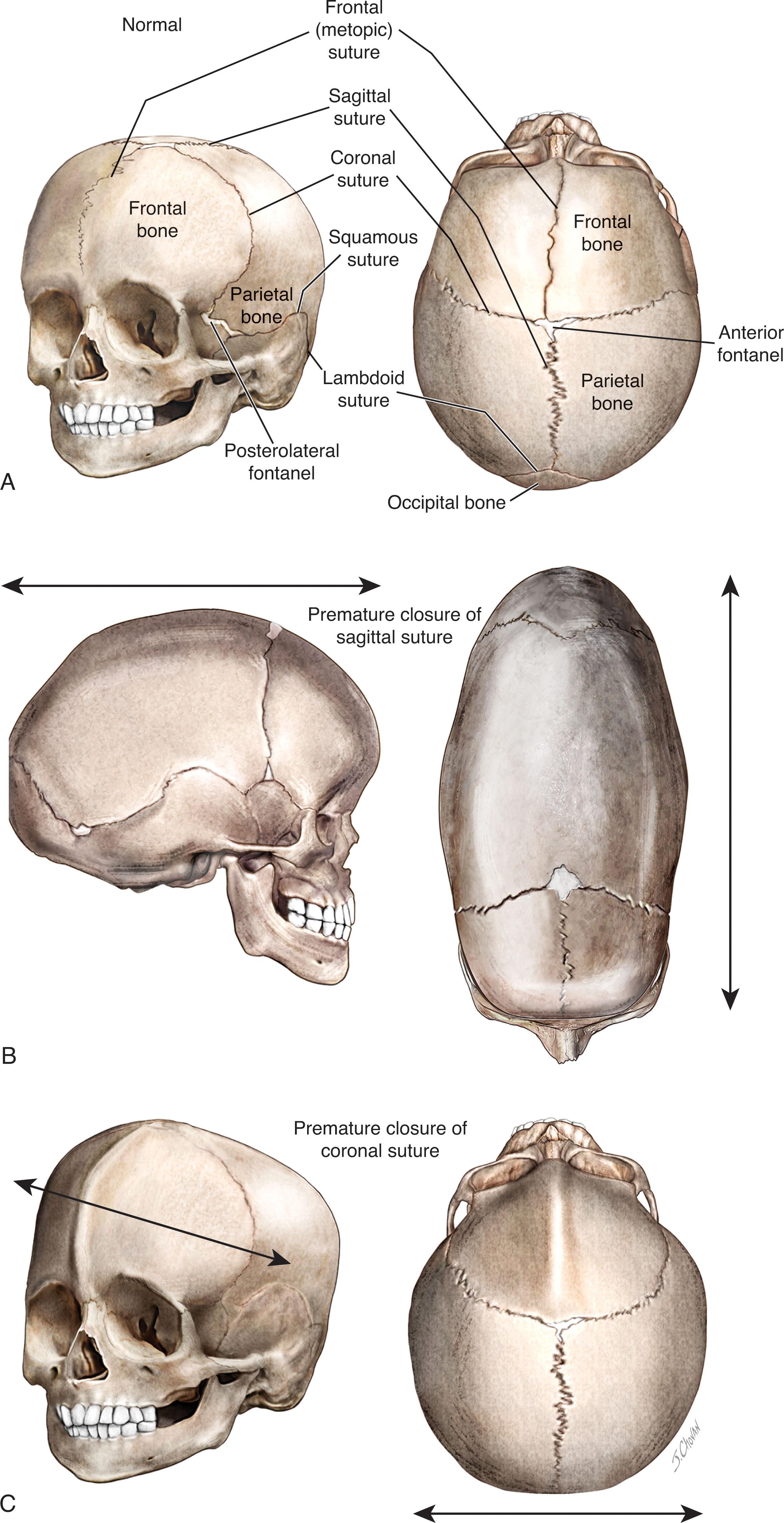 Neurological Examination: Normal and Abnormal Features - Clinical Tree