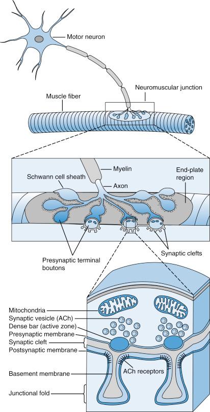 Neuromuscular Junction Diseases - Clinical Tree Neuromuscular Junction Diseases - Clinical Tree