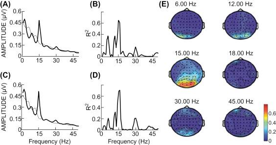 Noninvasive Brain–Computer Interfaces - Clinical Tree