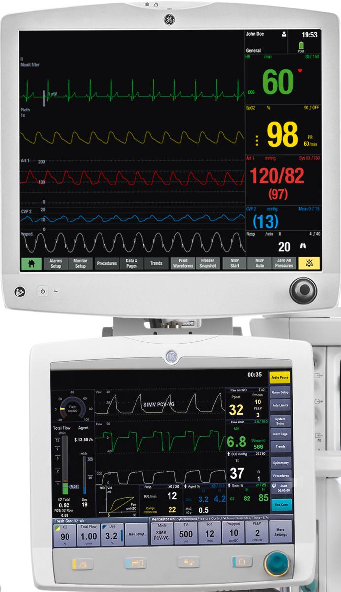 Noninvasive monitoring - Clinical Tree