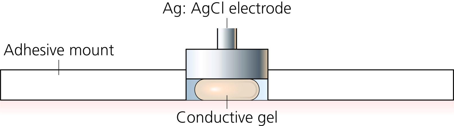 Noninvasive monitoring - Clinical Tree