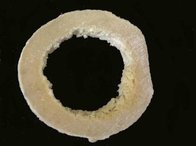 Normal Bone Anatomy - Clinical Tree