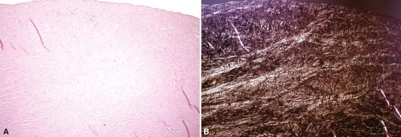 Normal Bone Anatomy - Clinical Tree