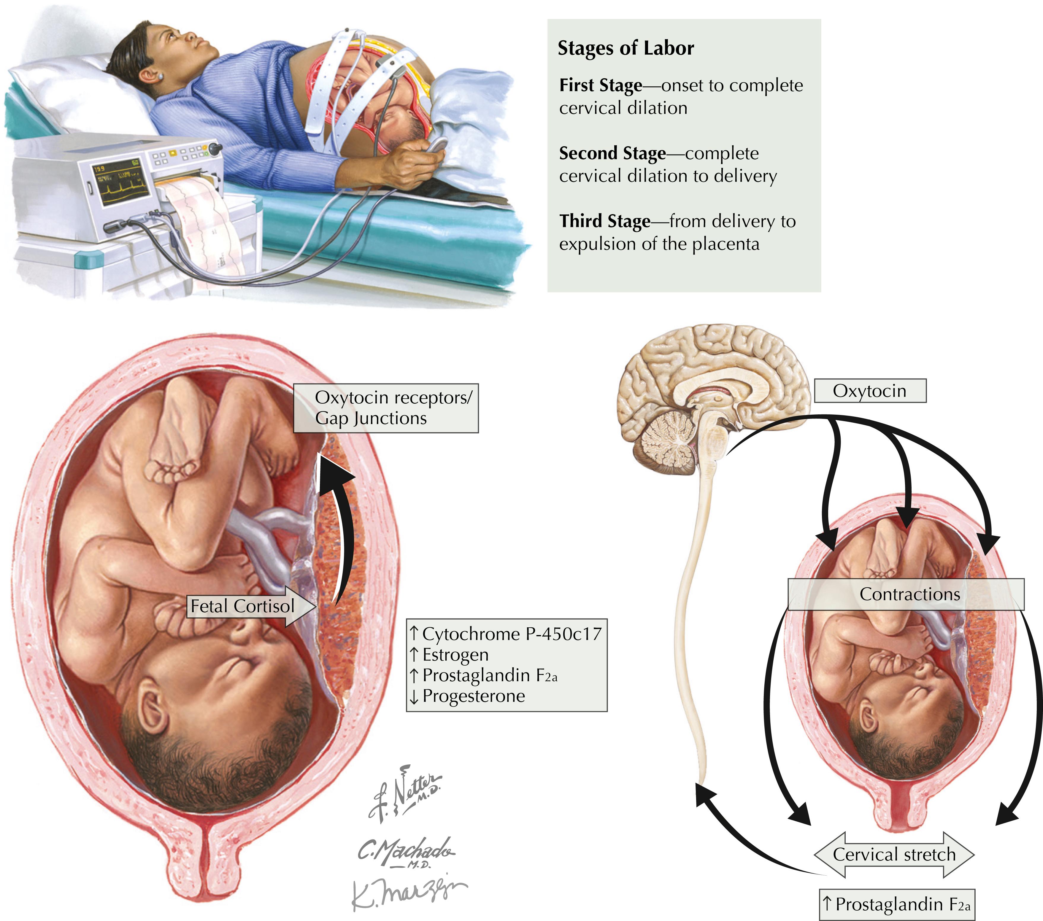 Normal Labor - Clinical Tree