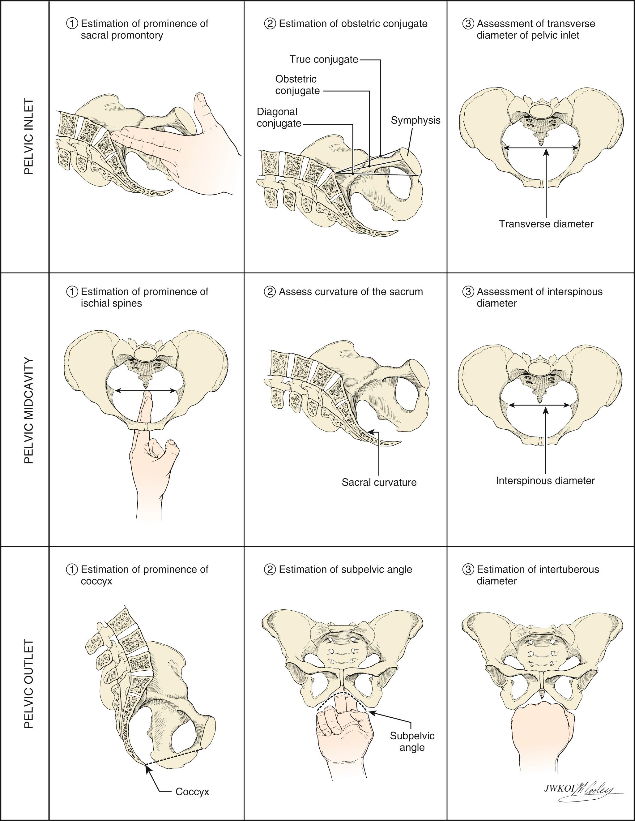 Normal Labor and Delivery - Clinical Tree