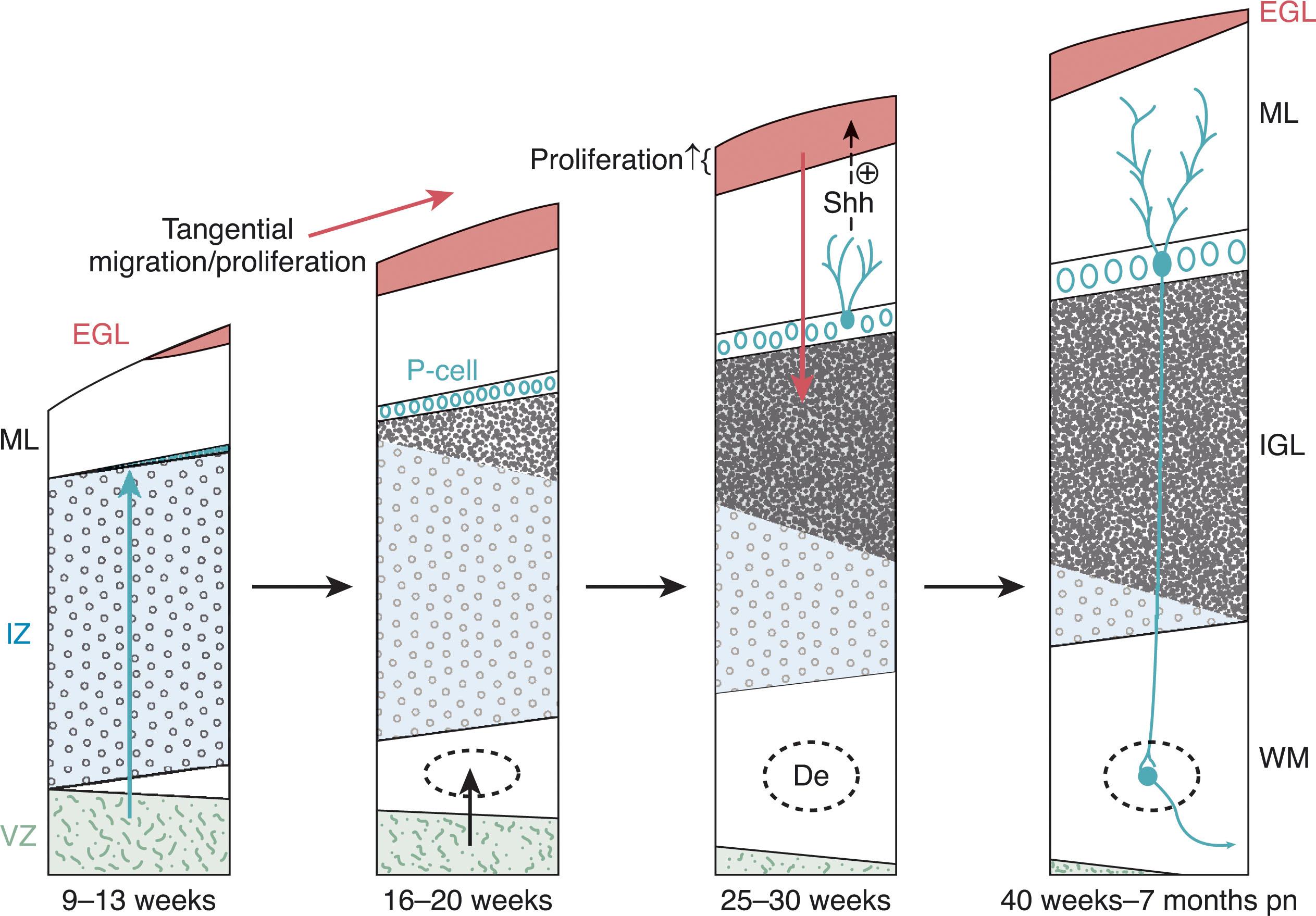 Normal and Abnormal Development of the Posterior Fossa Structures ...