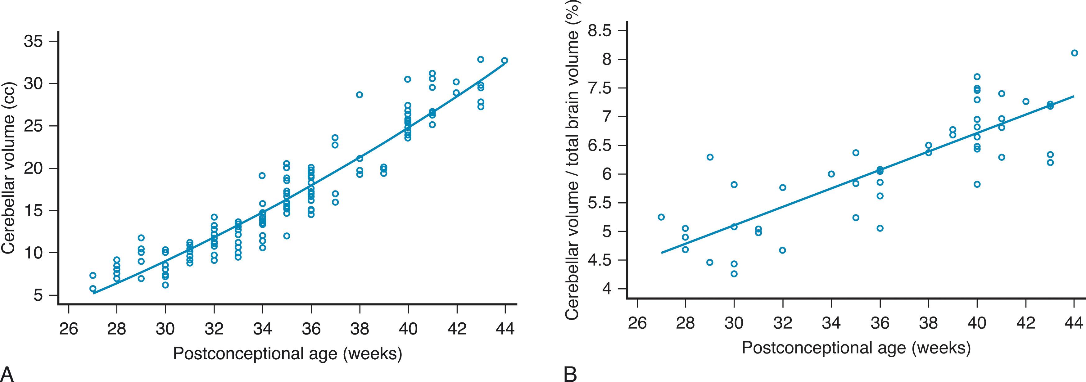 Normal and Abnormal Development of the Posterior Fossa Structures ...