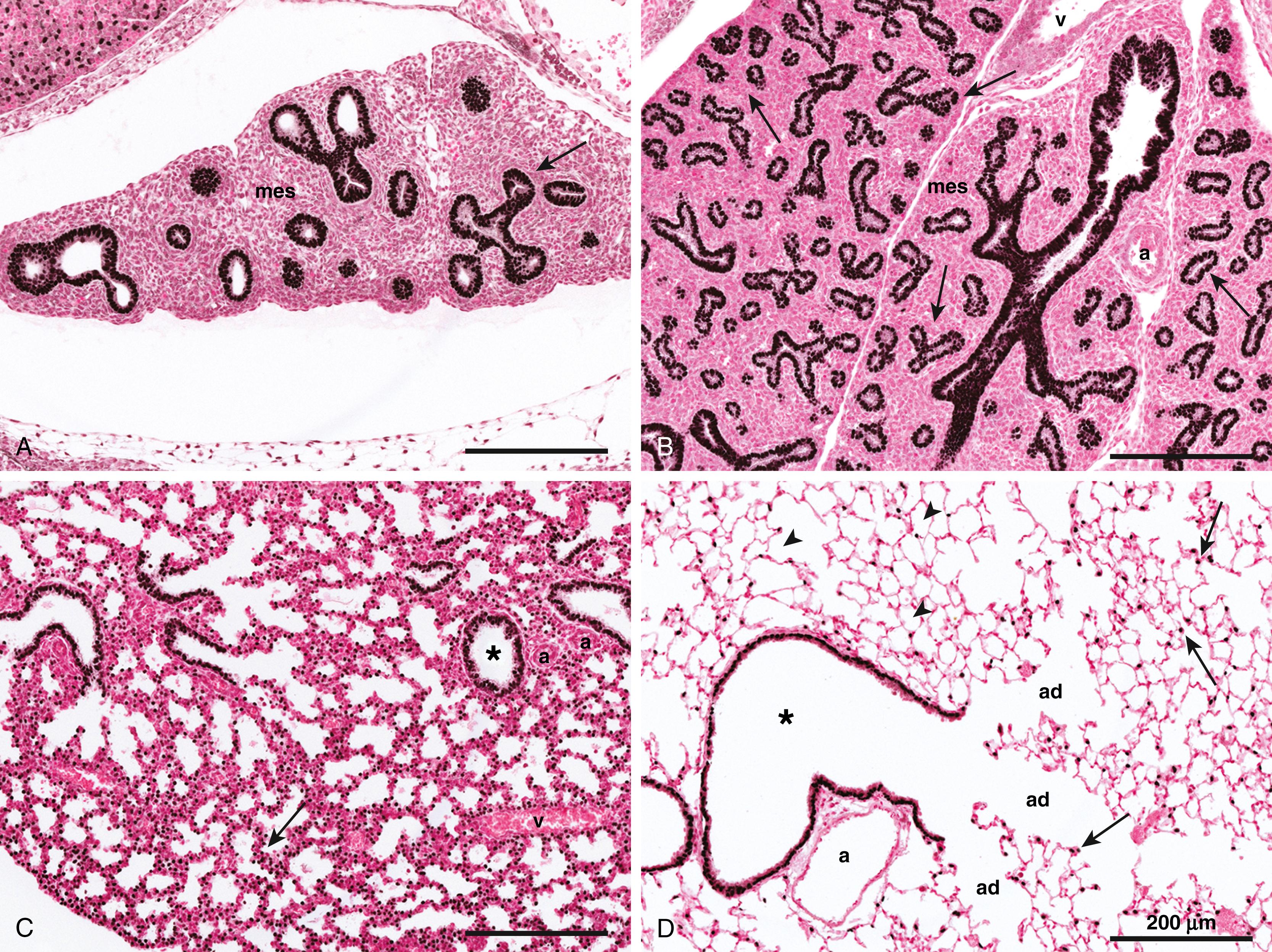 Normal and Abnormal Structural Development of the Lung - Clinical Tree