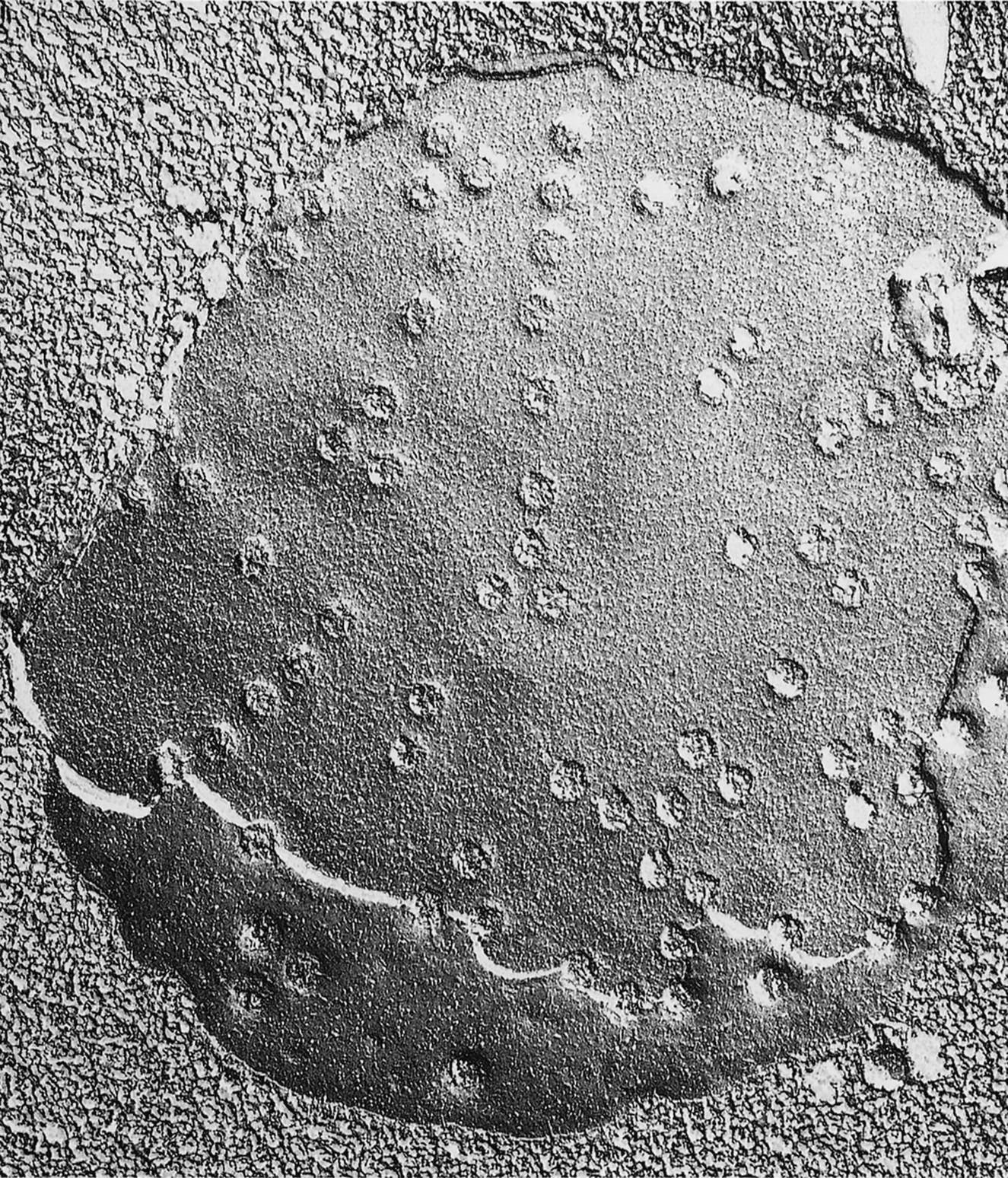 Nucleus - Clinical Tree