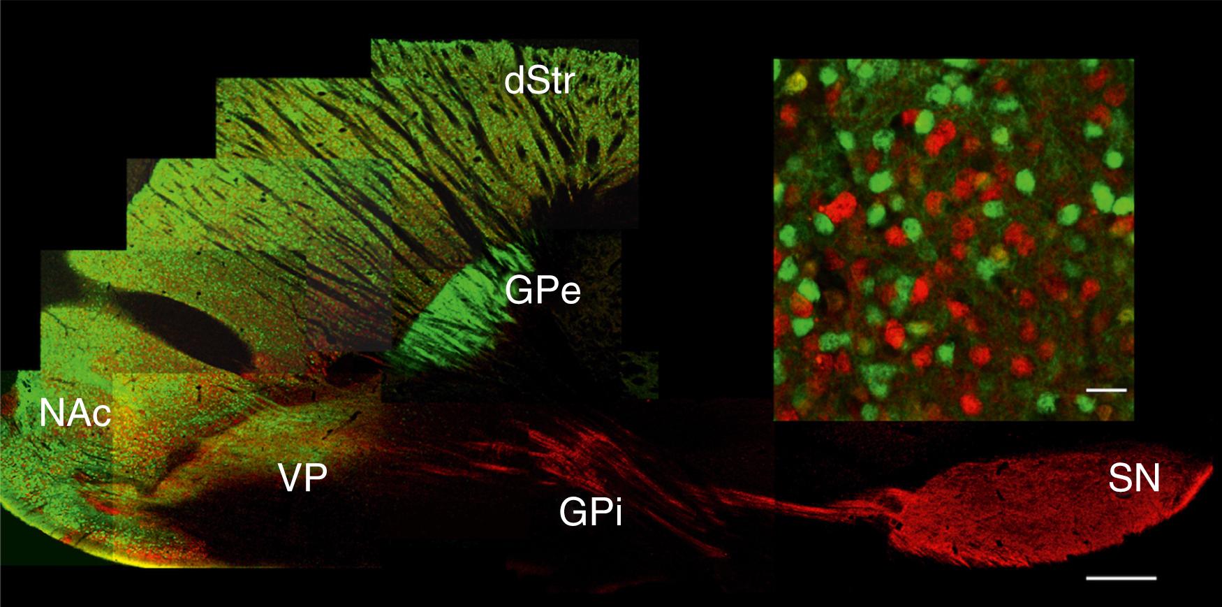 Overlapping Striatal Circuits and Molecular Mechanisms in Rodent Models ...